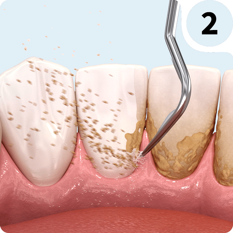 Treat bad breath quickly effectively – DR. HAGER | Dentists