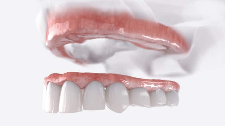 Total prosthesis – DR. HAGER | Dentists